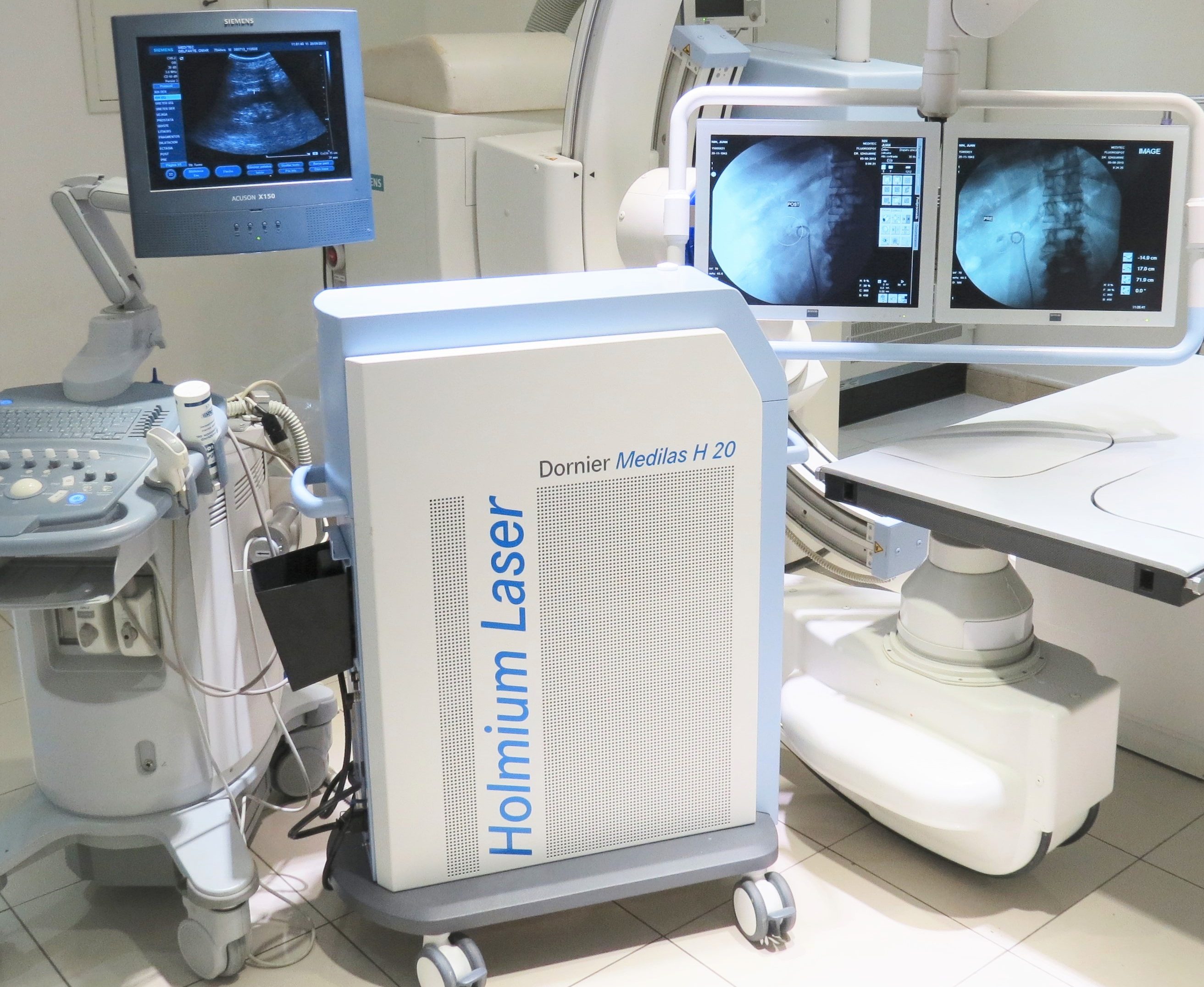 Litotricia Endourológica – cetil